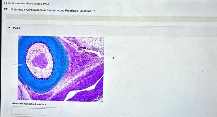 SOLVED: Part A Identify the highlighted structure. SOLVED: Part A Identify the highlighted structure.