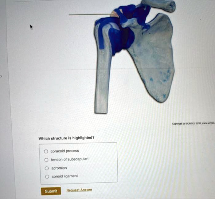SOLVED: Whlch structure I5 highlighted? coracoid process Iondon ol ...