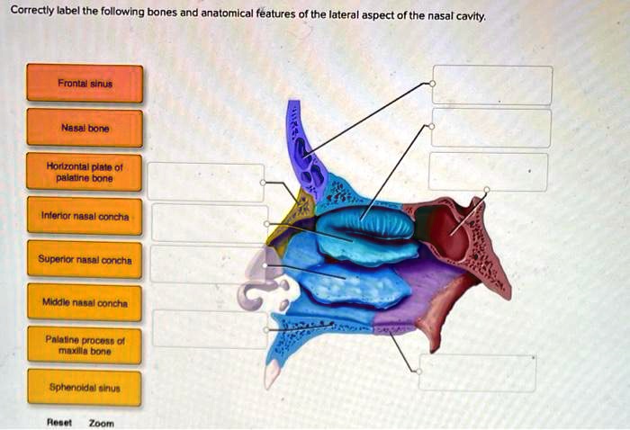 Correctly label the following bones and anatomical features of the ...
