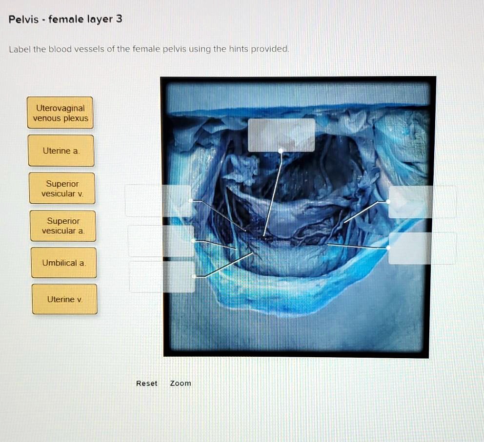 SOLVED: Pelvis - Female Layer 3 Label the blood vessels of the female pelvis using the hints ...