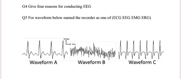 SOLVED:G4 Give four reasons for conducting EEG Q5 For waveform below ...