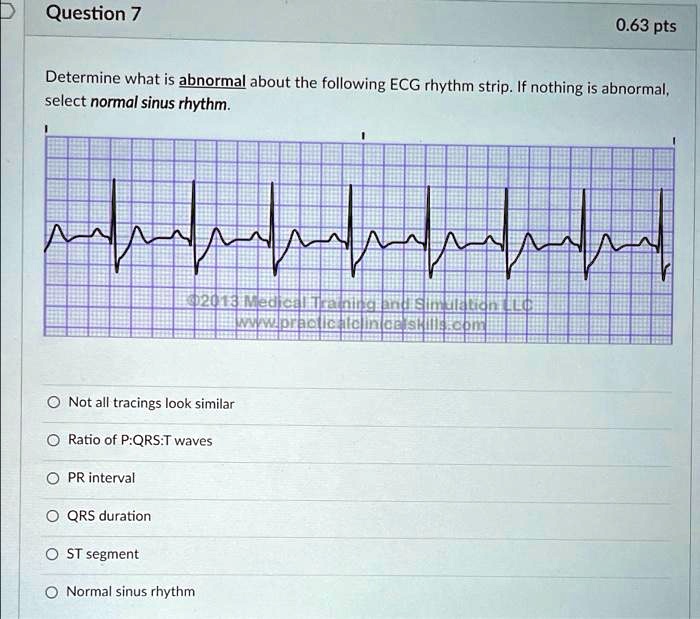 SOLVED: Determine what is abnormal about the following ECG rhythm strip ...