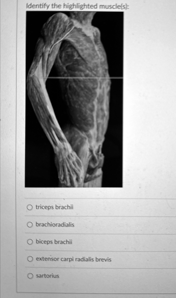 Identify the highlighted muscle(s): O triceps brachii O brachioradialis ...