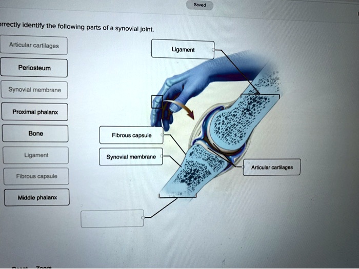 SOLVED: Saved rrectly identify the following parts of a synovial joint ...
