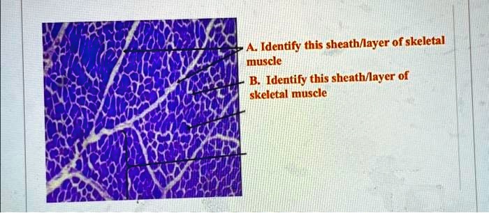 A. Identify this sheath/layer of skeletal muscle. B. Identify this ...