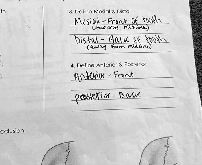 3. Define Mesial Distal Mesial - Front of tooth (towards midline ...