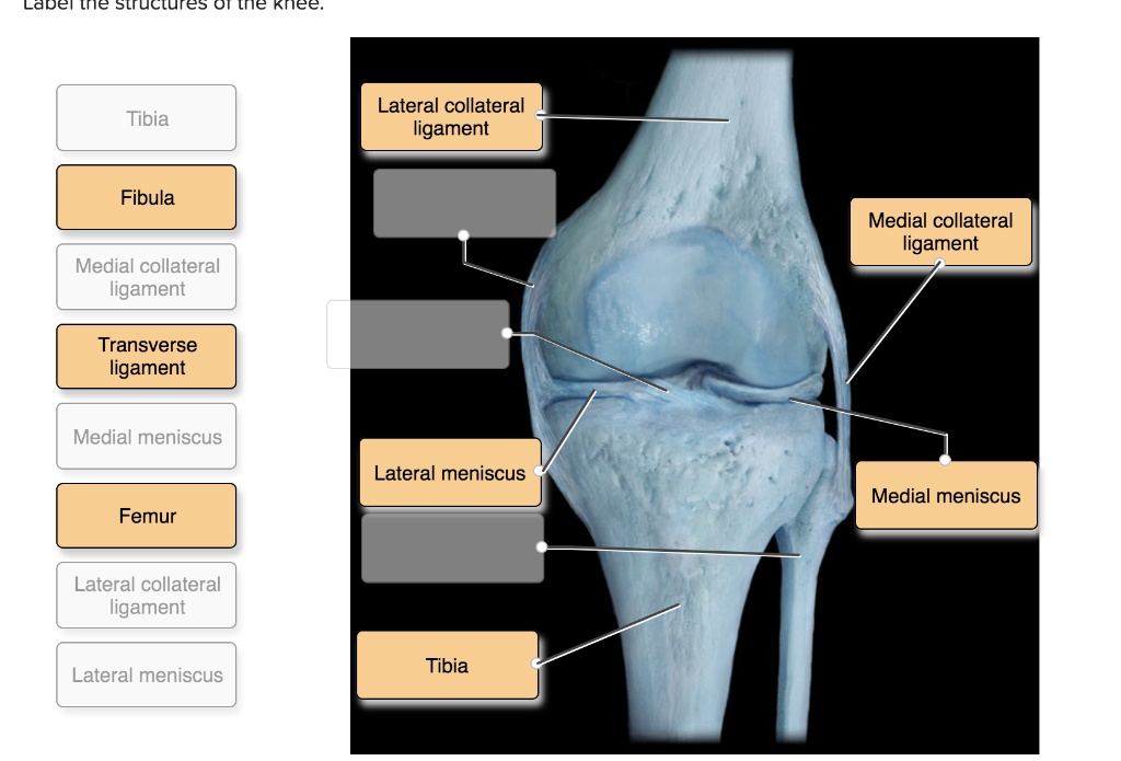 SOLVED: Lateral collateral ligament Tibia Fibula Medial collateral ...