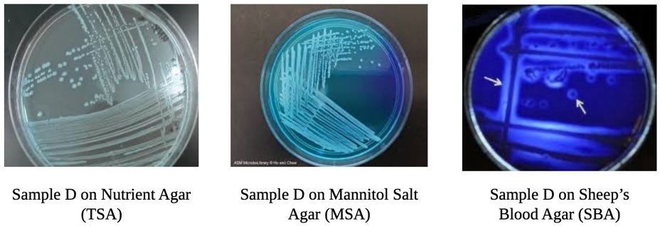SOLVED: "Sample D on Nutrient Agar (TSA) Sample D on Mannitol Salt Agar ...
