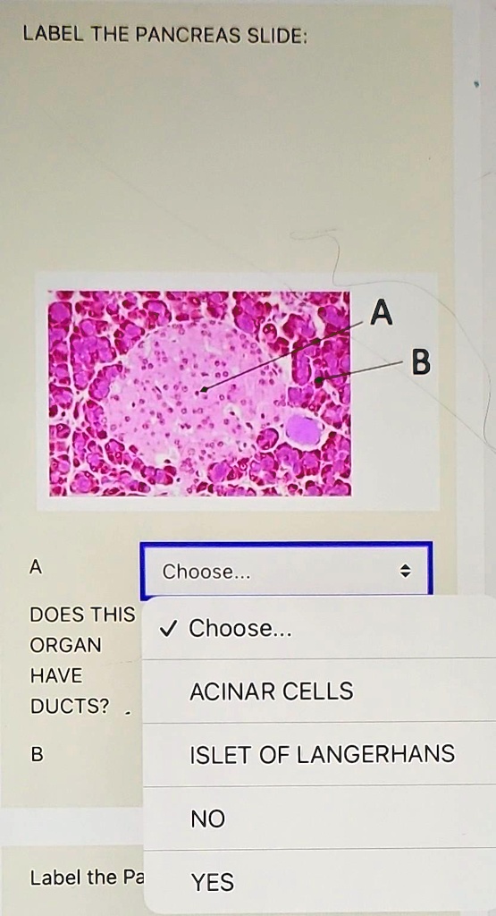 label the pancreas slide a b a choose does this v choose organ have ...