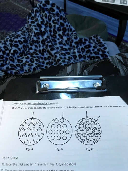 SOLVED: Model 3: Cross Sections through a Sarcomere Model 3 shows cross ...