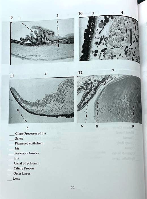 SOLVED: Ciliary Processes of Iris Scleral Pigmented Epithelium Iris ...