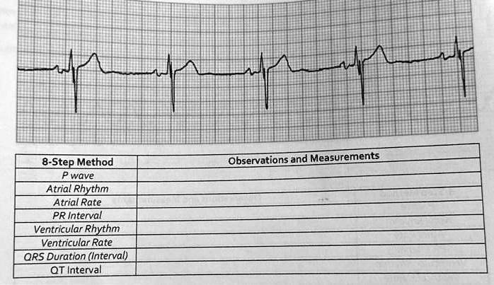8-Step Method P wave Atrial Rhythm Atrial Rate PR Interval Ventricular ...