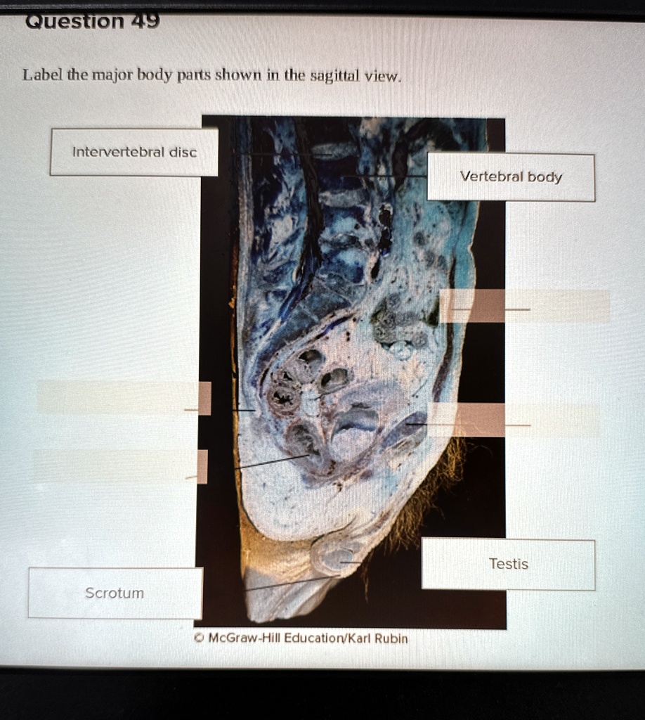 question 49 label the major body parts shown in the sagittal view ...