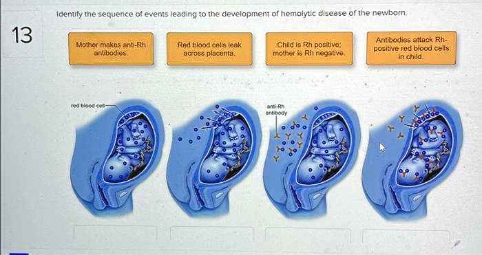 SOLVED: Identify the sequence of events leading to the development of ...