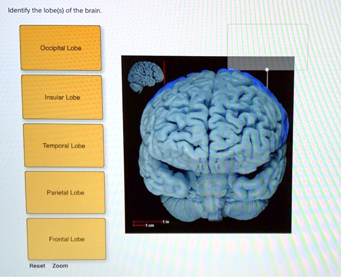 SOLVED: Identify the lobes of the brain: - Occipital Lobe - Insular ...