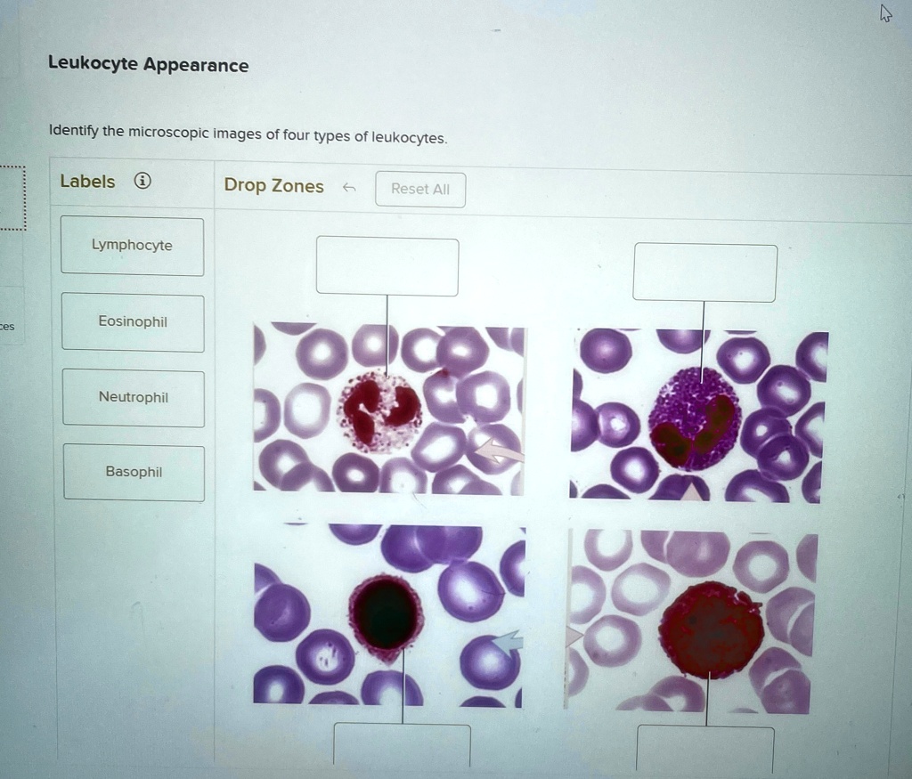 Leukocyte Appearance Identify the microscopic images of four types of ...