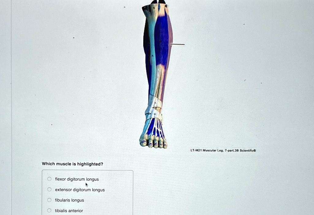 [GET ANSWER] Which muscle is highlighted? flexor digitorum longus ...