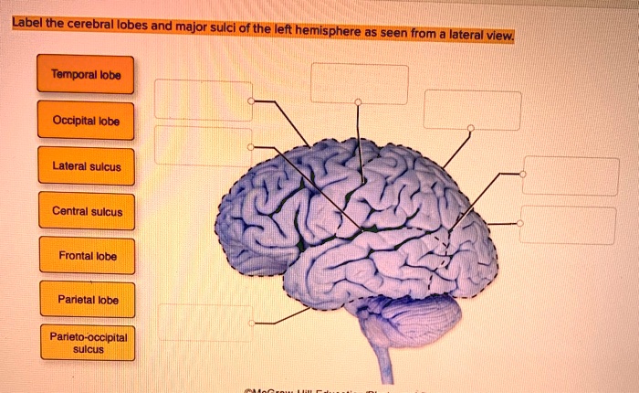 Label the cerebral lobes and major sulci of the left hemisphere as seen ...