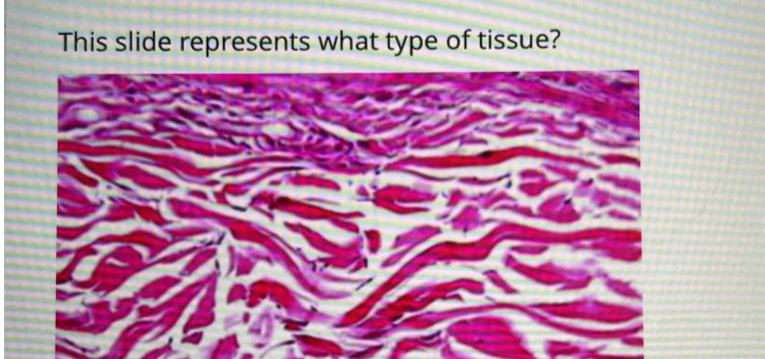 SOLVED: This slide represents what type of tissue?