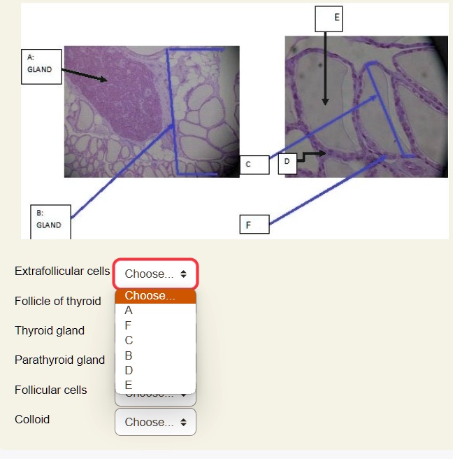 [GET ANSWER] A: GLAND B: GLAND Extrafollicular cells Follicle of ...