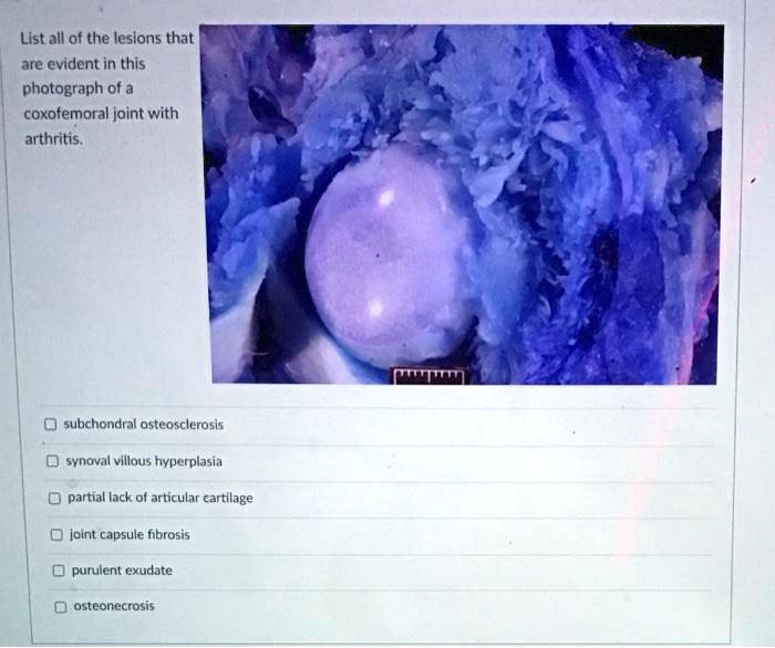 List all of the lesions that are evident in this photograph...