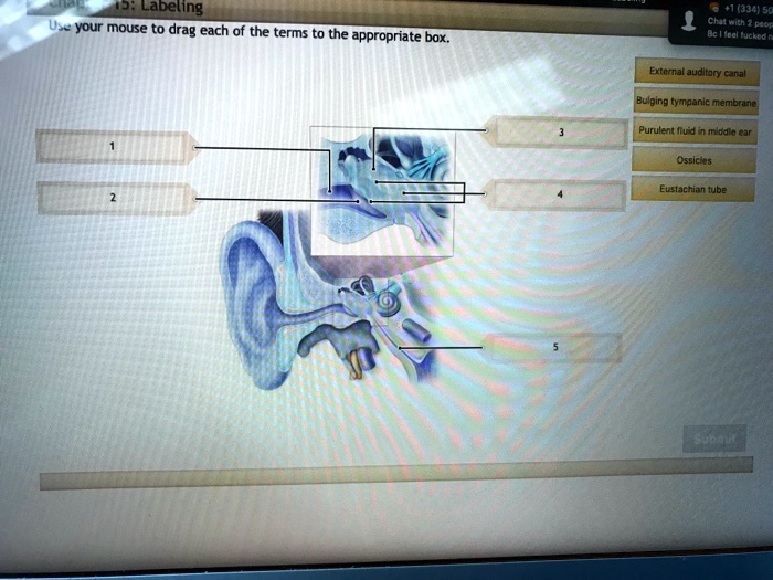 chap 15: Labeling Use your mouse to drag each of the terms to the ...
