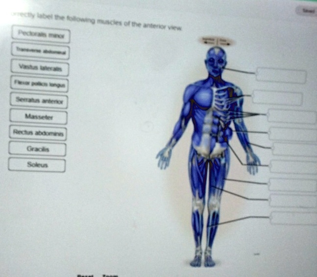 orrectly label the following muscles of the anterior view Pectoralis ...