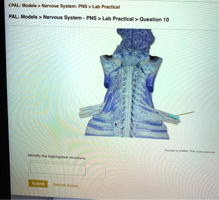 SOLVED: Text: Nervous System:PNS>Lab Practical PAL Models>Nervous System-PNS>Lab Practical ...