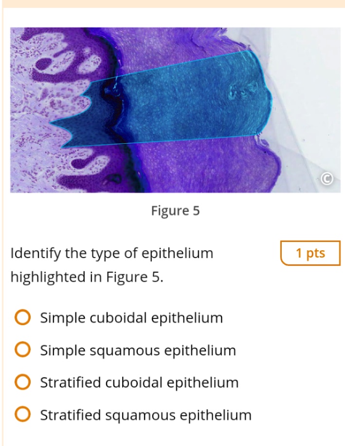 SOLVED:Figure 5 Identify the type of epithelium highlighted in Figure 5 ...