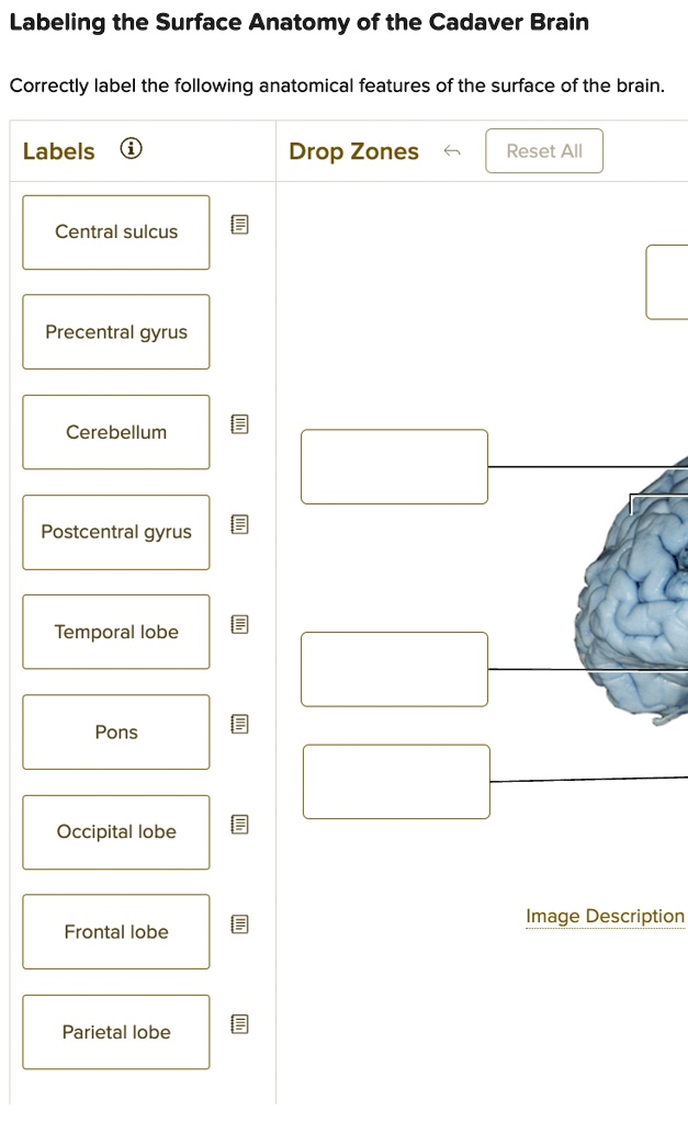 Labeling the Surface Anatomy of the Cadaver Brain Correctly label the ...
