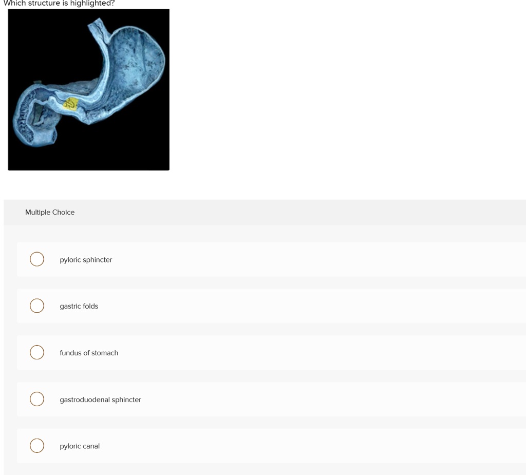 Which structure is highlighted? Multiple Choice pyloric sphincter ...