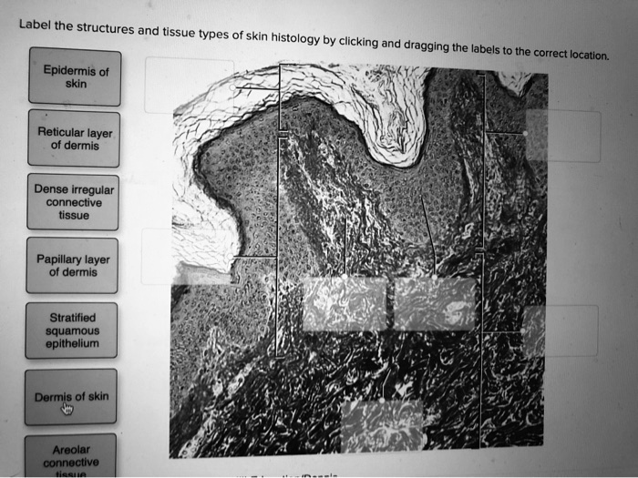 [GET ANSWER] label the structures and tissue types of skin histology by ...