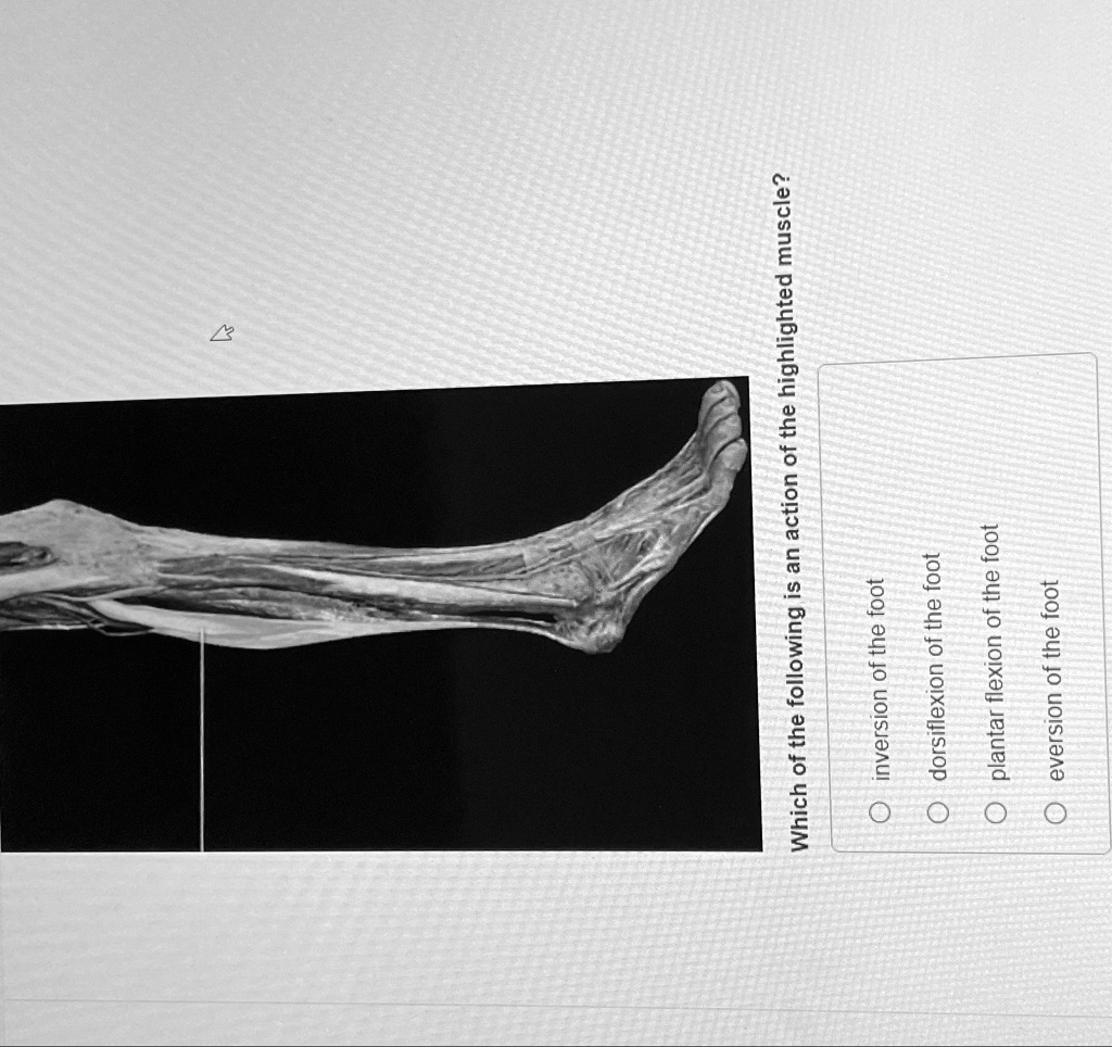 Which of the following is an action of the highlighted muscle ...