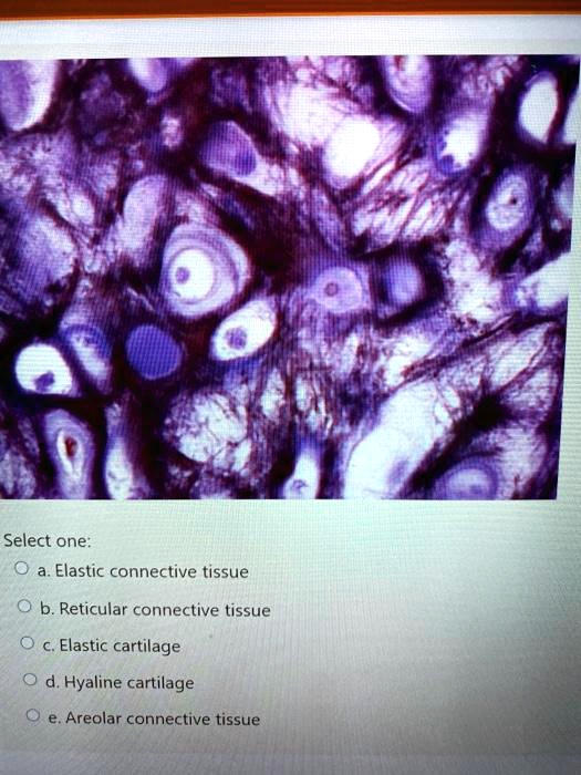 SOLVED: Select one: Elastic connective tissue b. Reticular connective ...