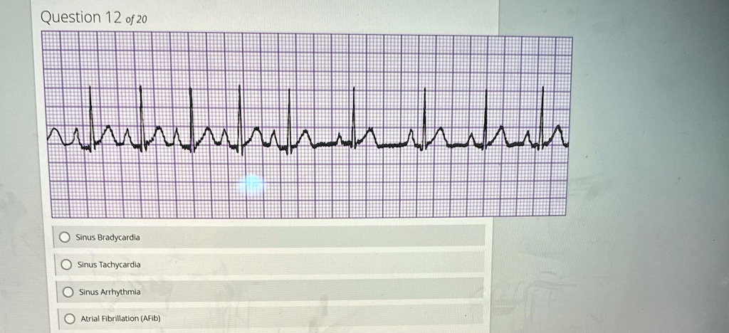question 12 of 20 sinus bradycardia sinus tachycardia sinus arrhythmia ...