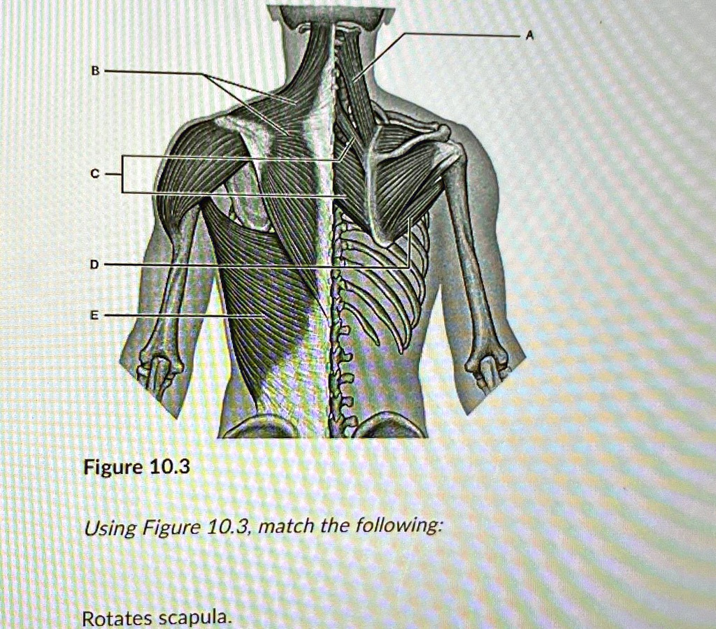 Upwardly Rotated Scapula