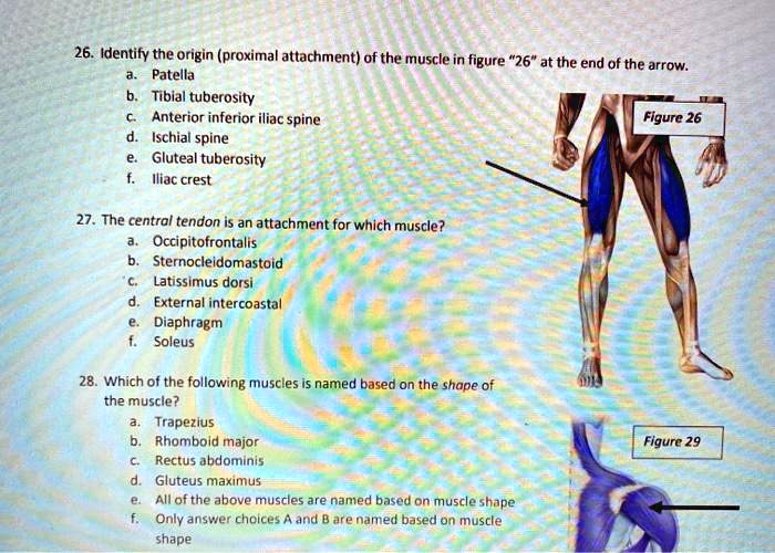 SOLVED: 26. Identify the origin (proximal attachment) of the muscle in ...