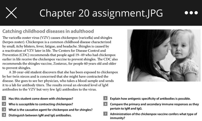 SOLVED: Chapter 20 assignment.JPG Catching childhood diseases in ...