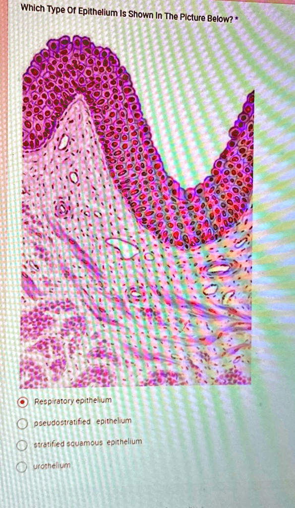 Which type of epithelium is shown in the picture below? Respiratory ...