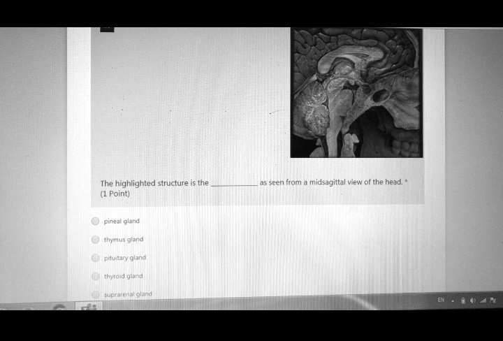 The highlighted structure is the as seen from a midsagittal view of the head. * (1 Point) pineal ...