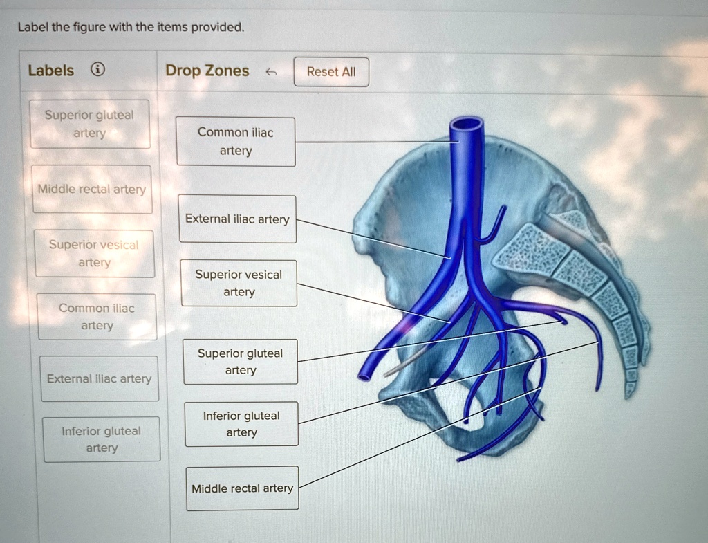 label the figure with the items provided labels drop zones superior ...