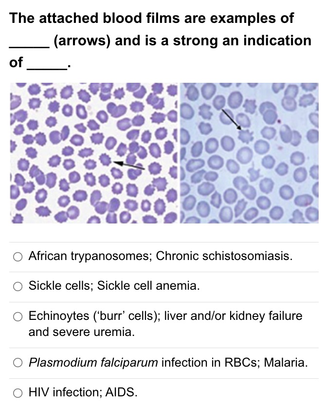 The attached blood films are examples of: - African trypanosomes ...