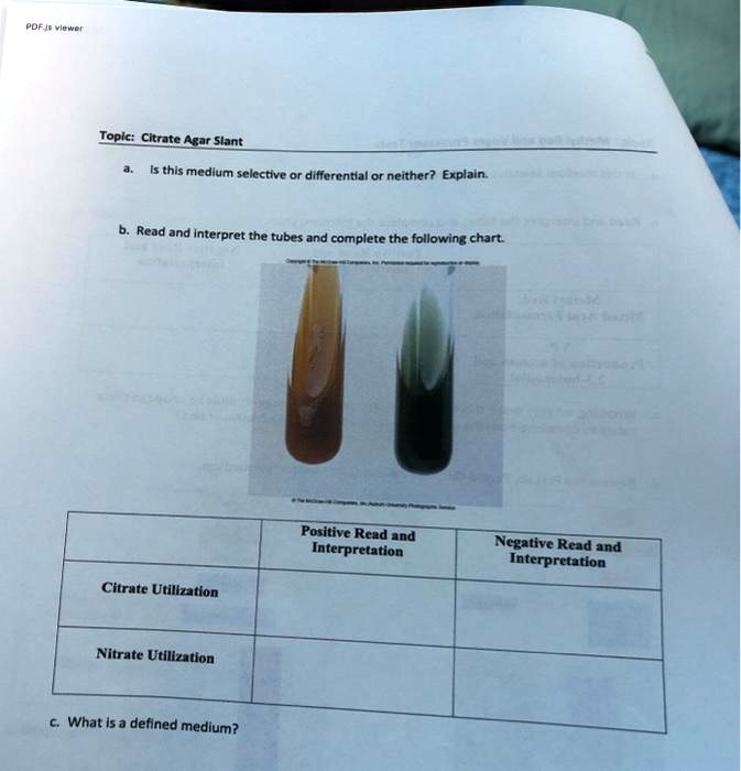 Title: Citrate Agar Slant This medium is selective or differential ...