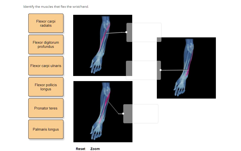identify the muscles that flex the wristhand identify the muscles that ...