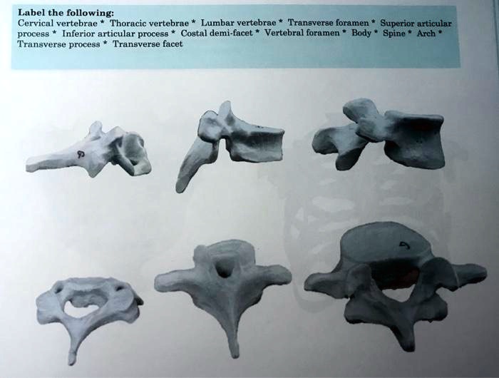 Label the following: Cervical vertebrae * Thoracic vertebrae * Lumbar ...