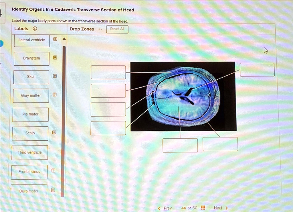 SOLVED: Identify Organs In a Cadaveric Transverse Section of Head Label ...