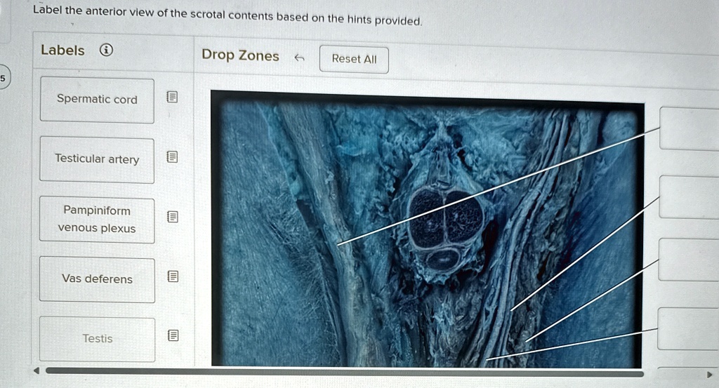 Label the anterior view of the scrotal contents based on the hints ...