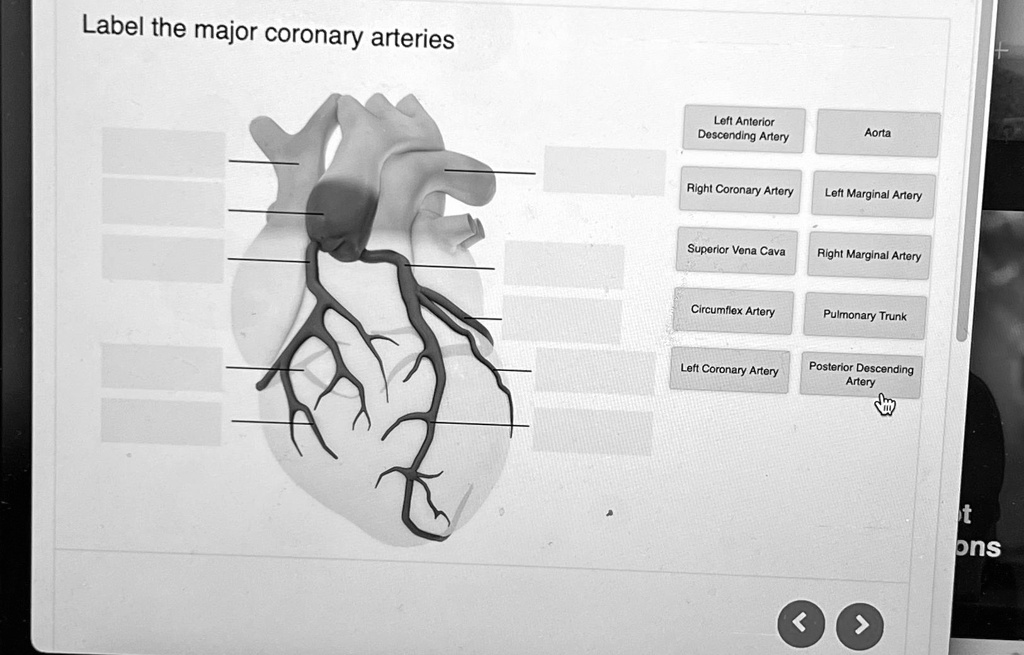 SOLVED: Label the major coronary arteries ons Label the major coronary ...