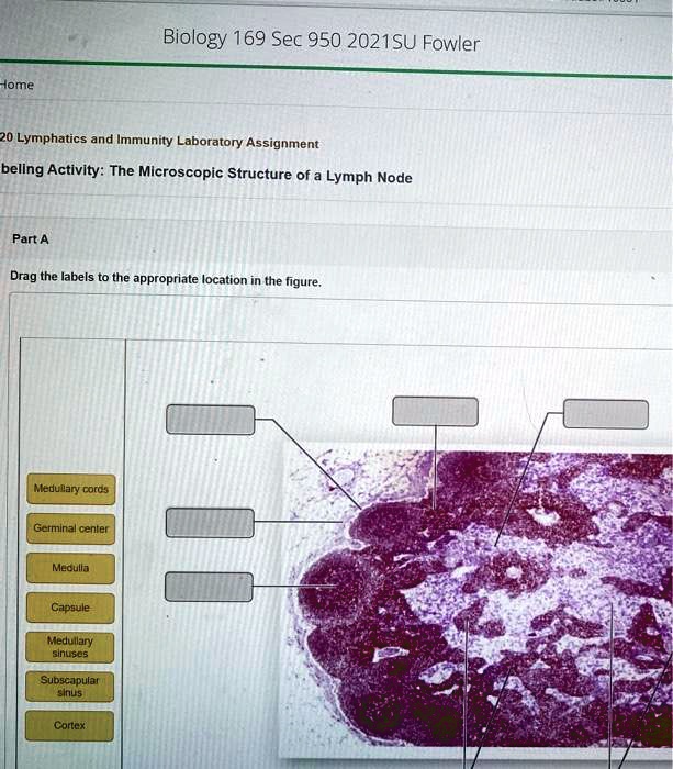 SOLVED: Biology 169 Sec 9502021SU Fowler Home 20 Lymphatics and Immunity Laboratory Assignment ...