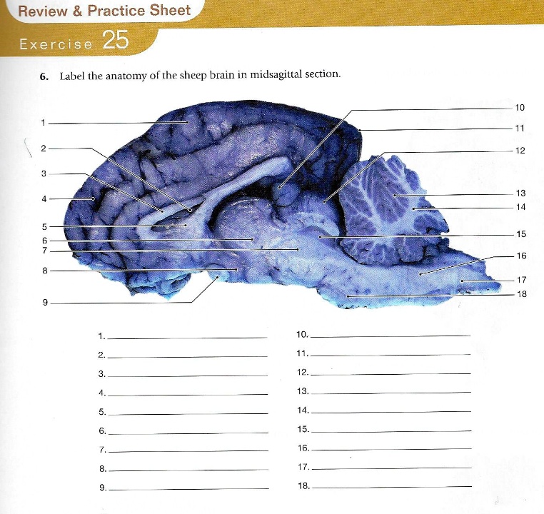 Midsagittal Section Of The Brain Color Coded